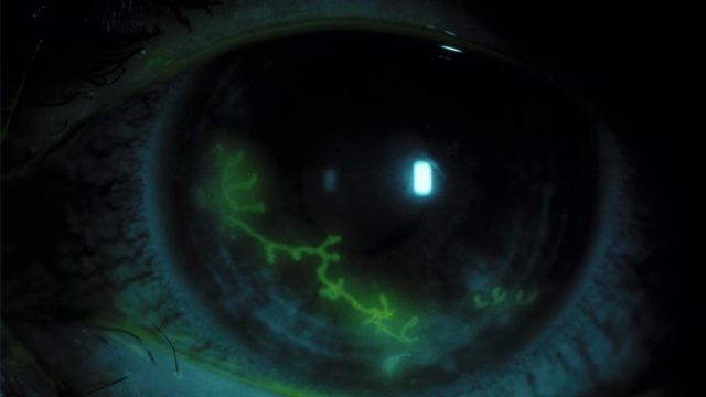 Patient Education Articles - South Bay Ophthalmology